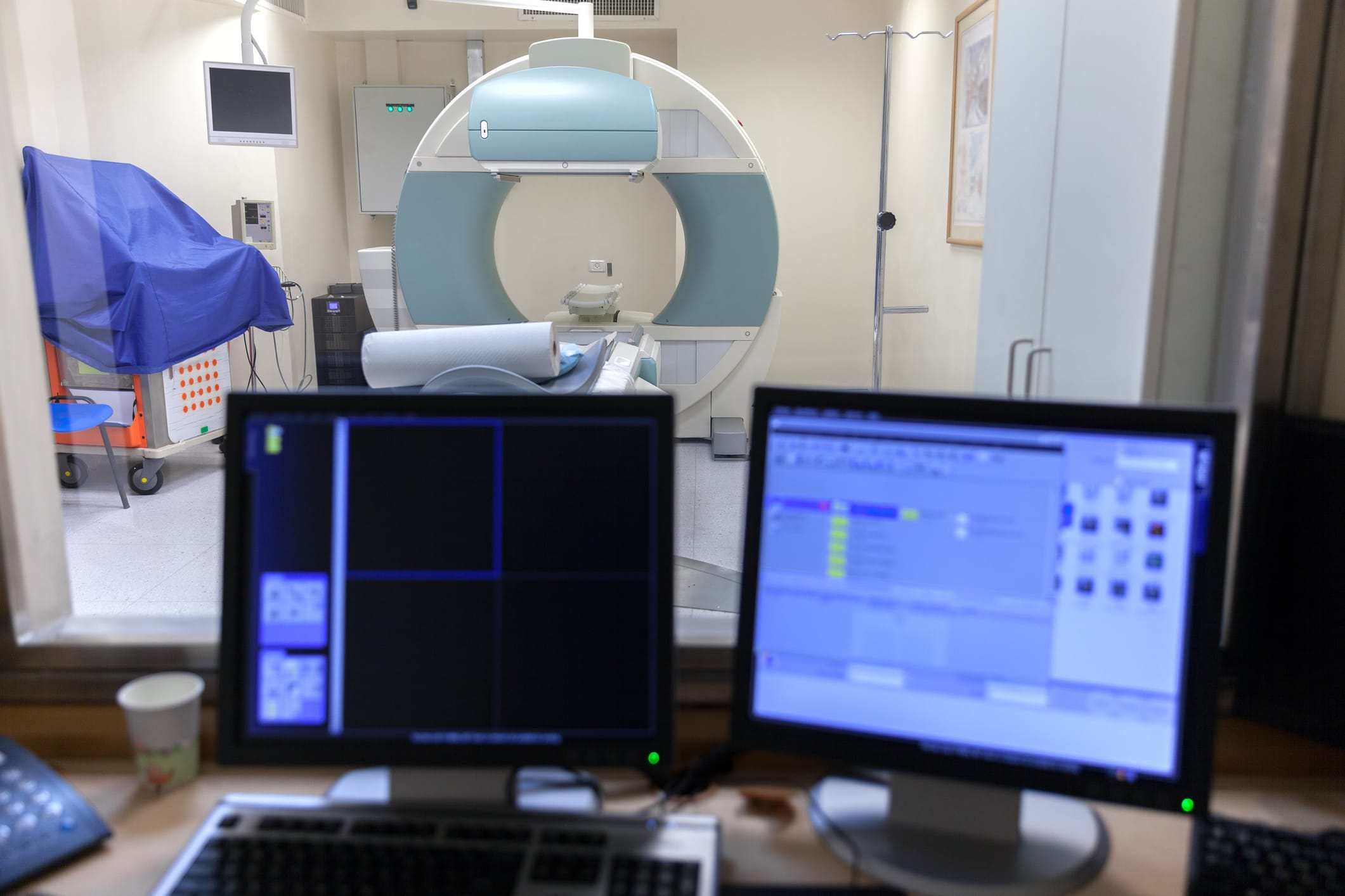 New SPECT/CT approach may improve ATTR-CM diagnosis